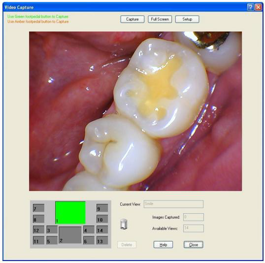 Schick – MouthWatch Help Center